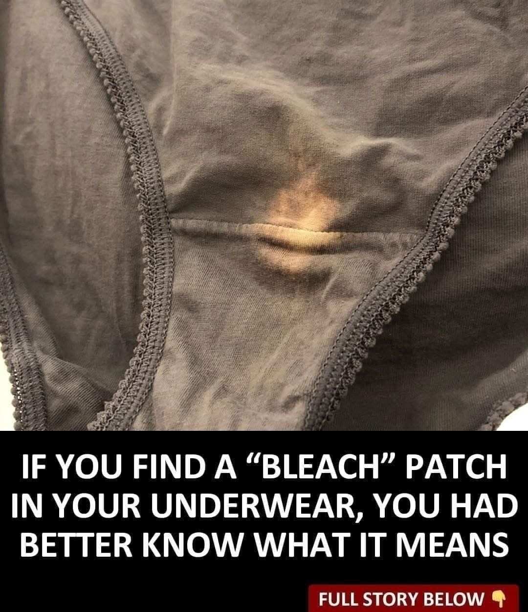 Some people are just finding out why they get bleach patches on their ...